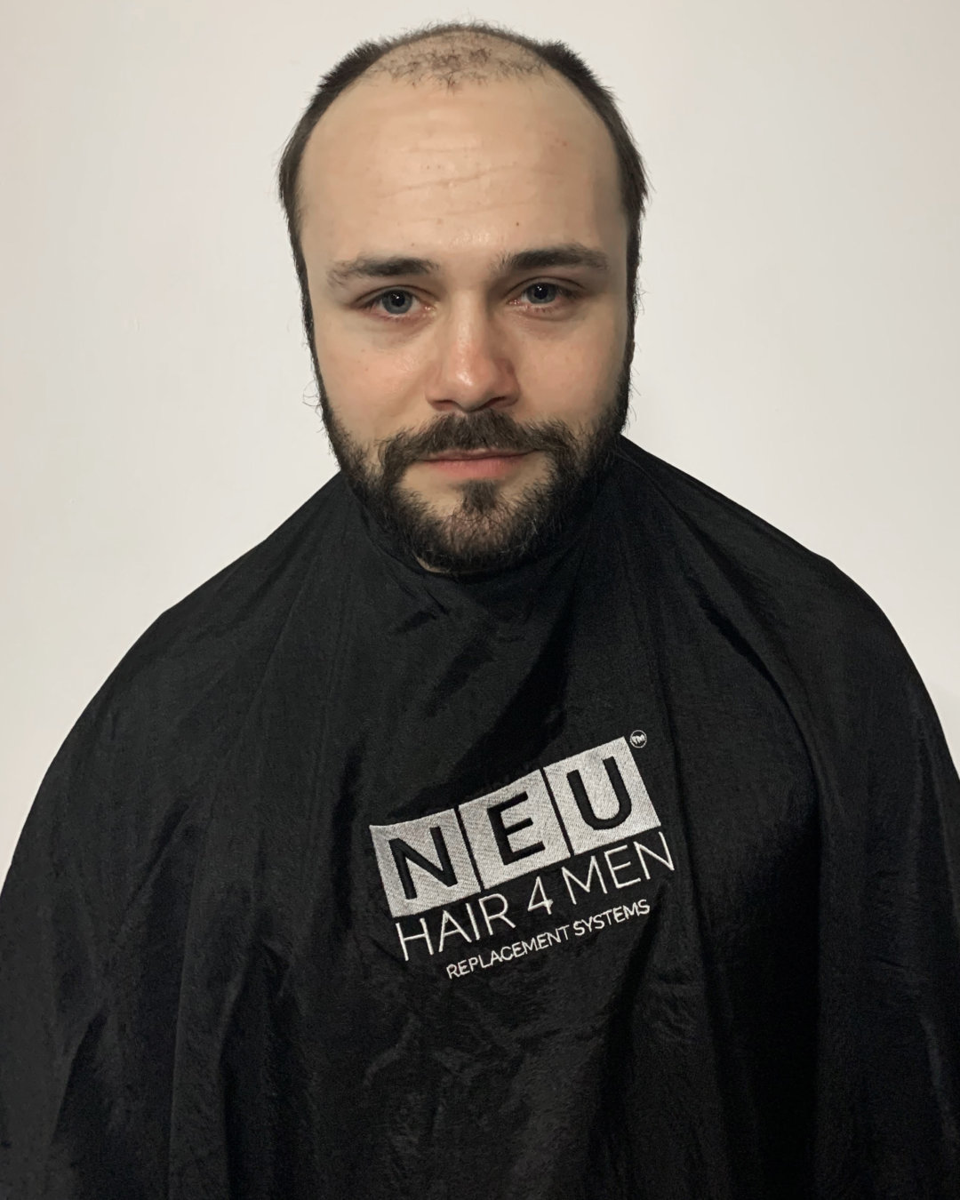 Dreamline | Man's Hairpiece | 100% Human Hair - NEU Hair 4 Men