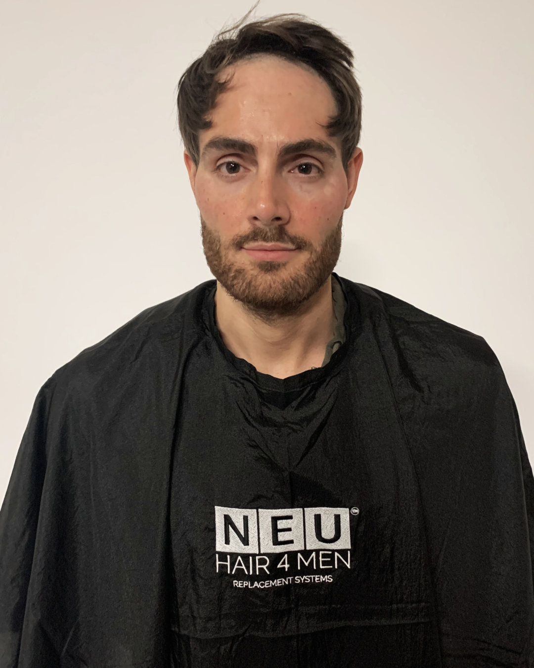 Micro Line | Ultra Thin Skin Mens Hair System | 100% Human Hair - NEU ...