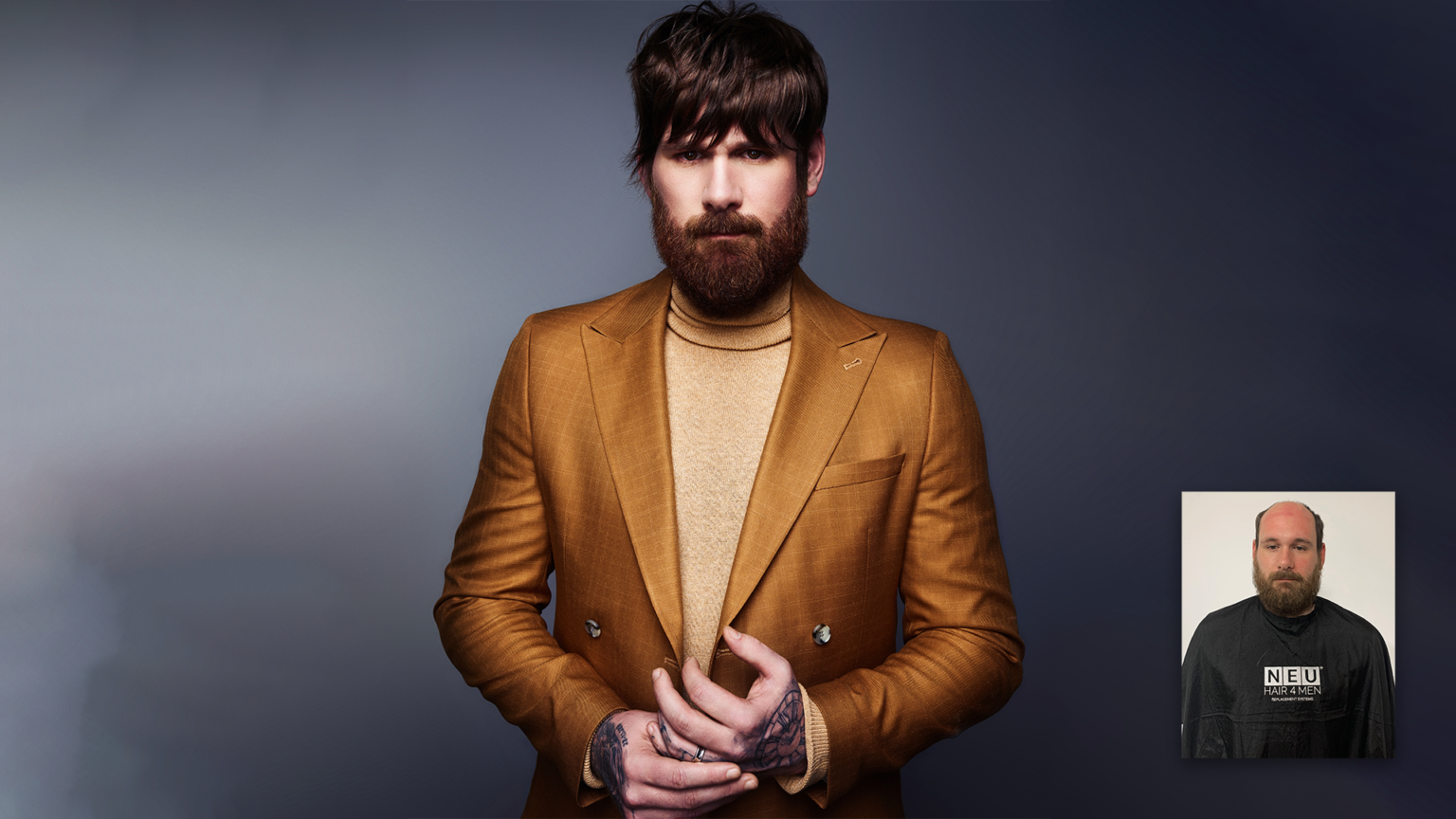 Mens Hair Systems | Male Hair Replacement Systems | Online Store