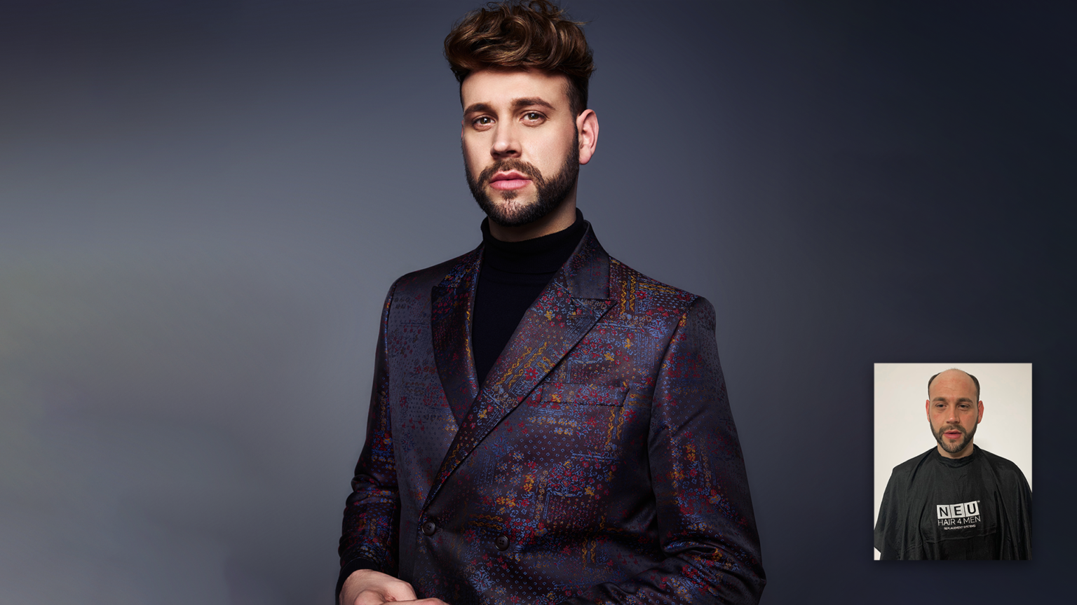 Mens Hair Systems | Male Hair Replacement Systems | Online Store